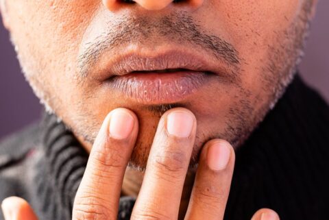 Dry Mouth: Causes, Symptoms, and Solutions - bluem® UK